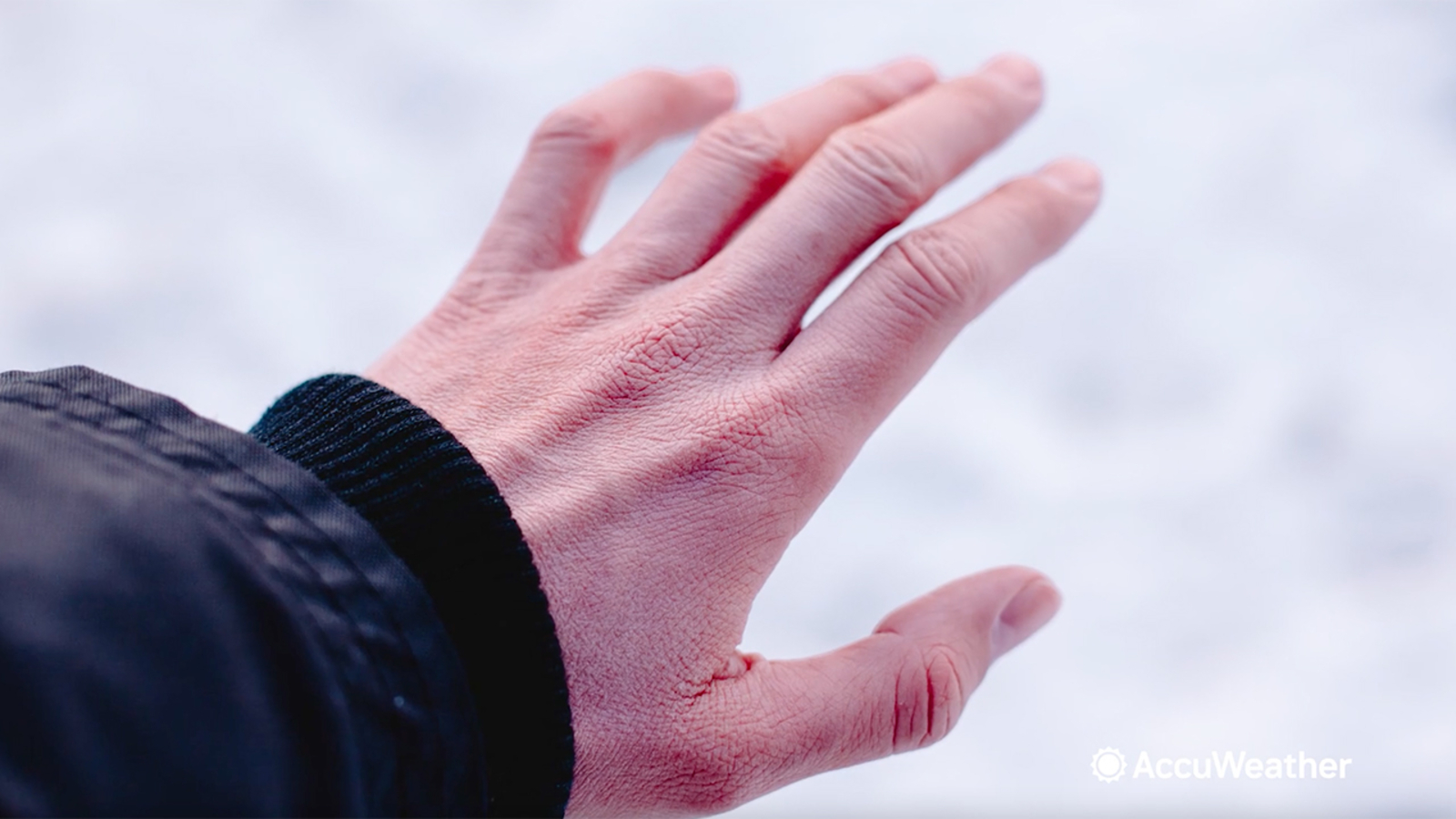 Hypothermia and frostbite | What's the difference frostbite and ...