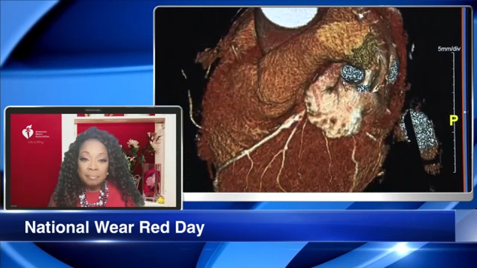 National Wear Red Day 2021: American Heart Association's mission raises ...