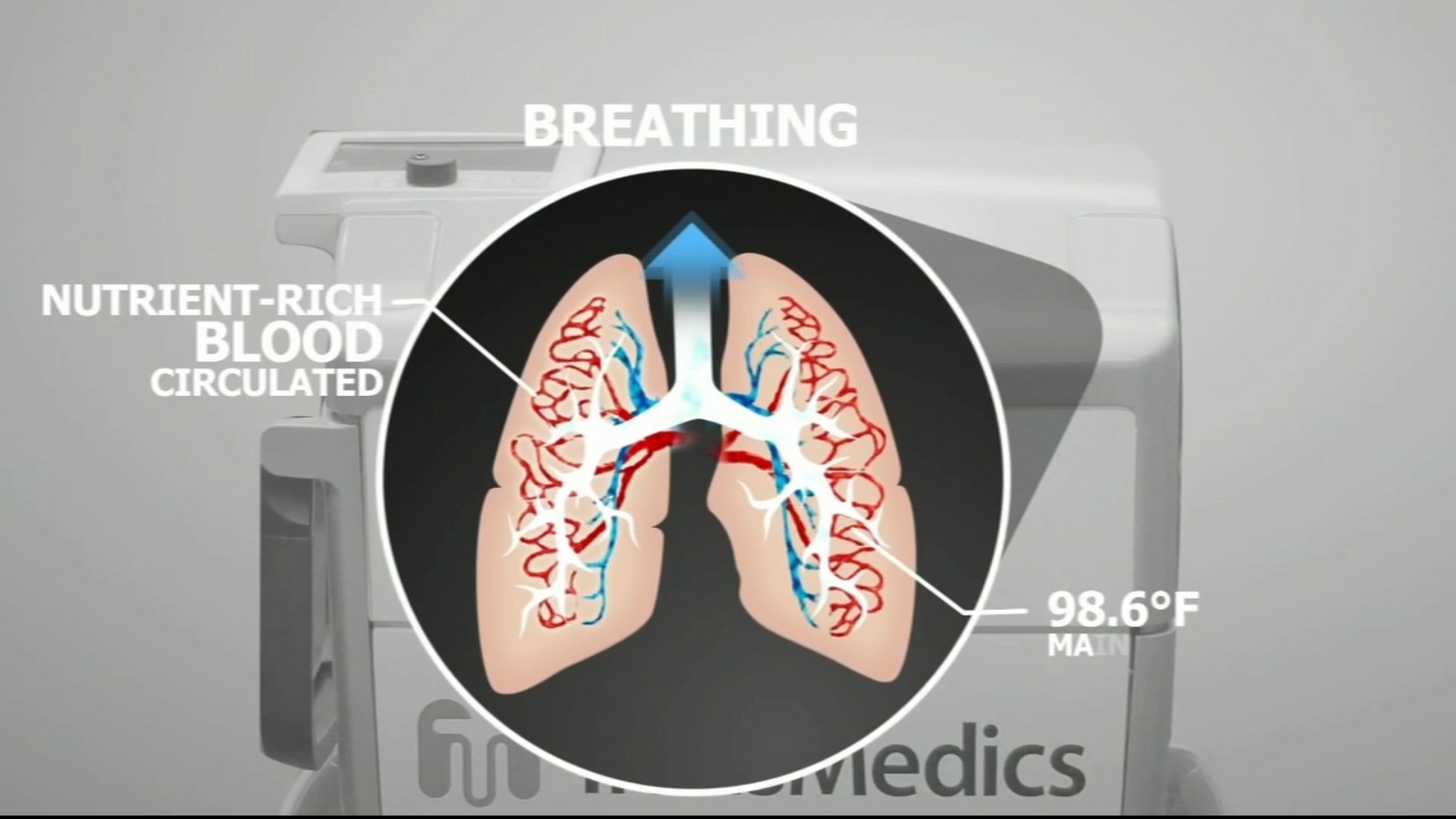 Local man gets life-saving "breathing lungs" - 6abc Philadelphia