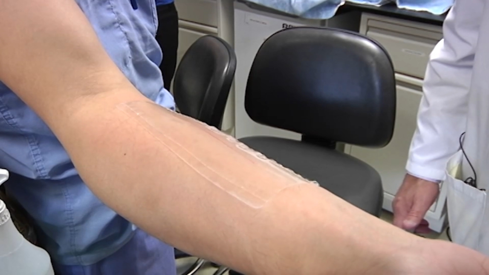 Stanford testing anti-scarring drug - ABC7 San Francisco