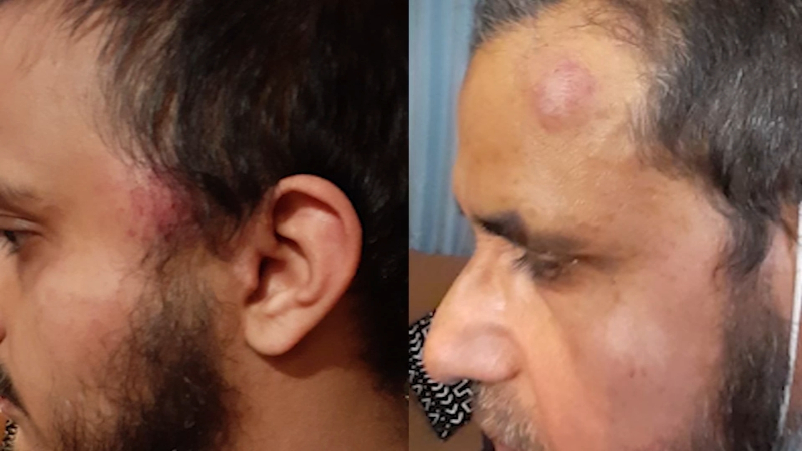 Road rage NYC: Father, son brutally attacked after fender bender in ...