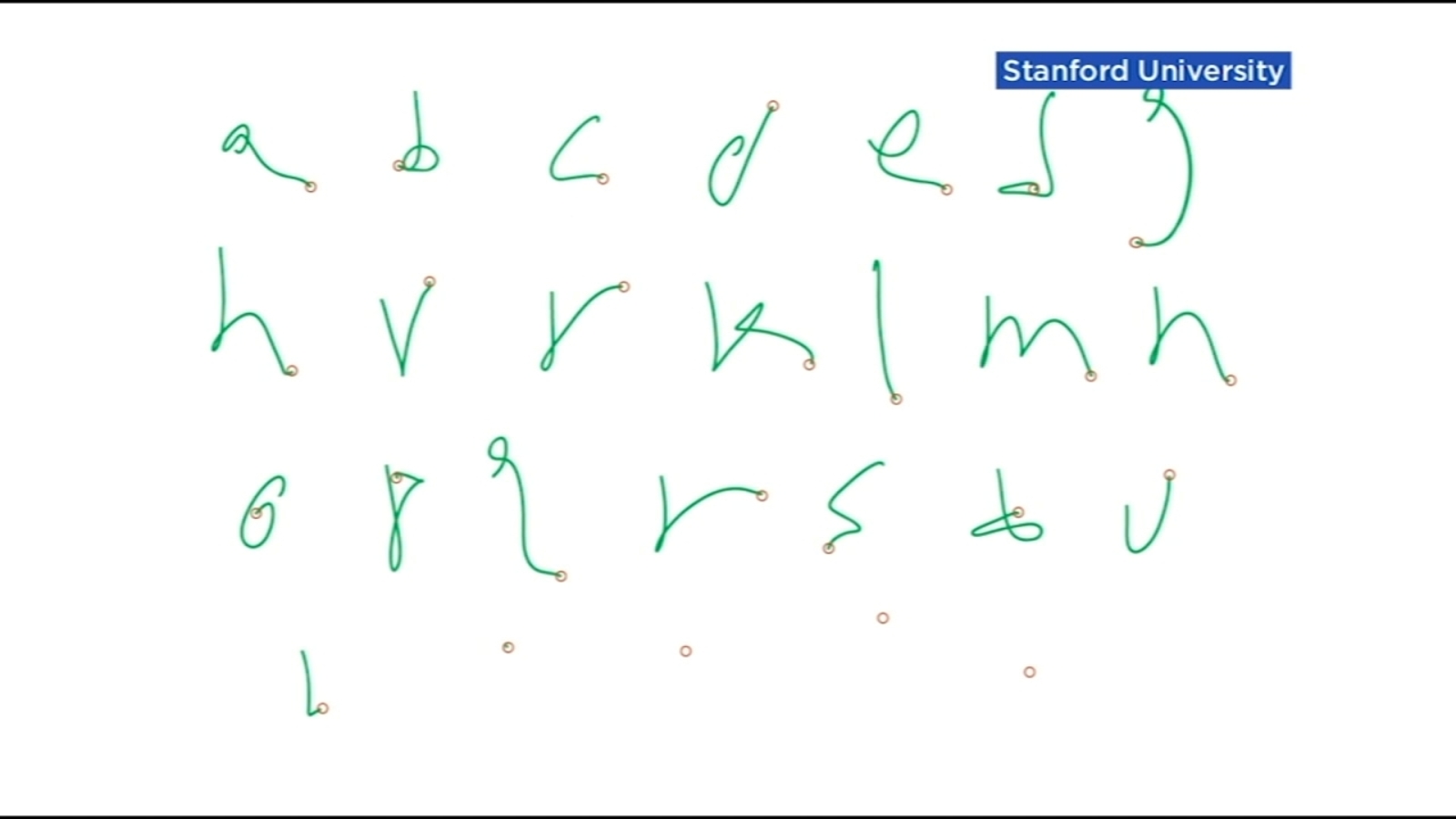 Breakthrough Stanford research allows paralyzed to write words with ...