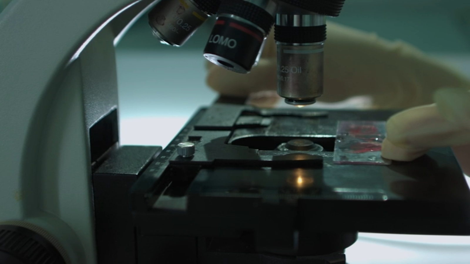 Duke team developing test to determine whether patient's infection is ...