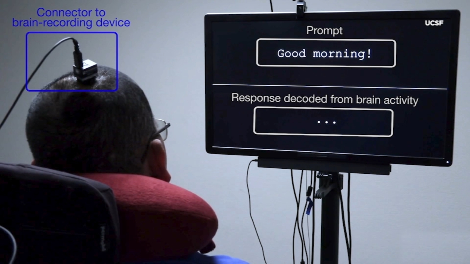 UCSF brain technology gives nonverbal paralysis patient speech - ABC7 ...