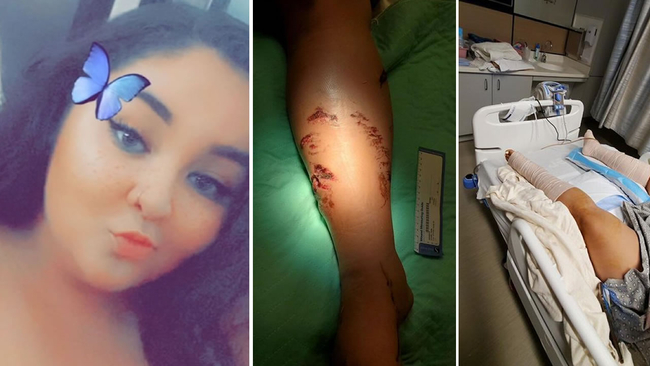 12-year-old boy Charlie Buhl describes crocodile attack, rescue at ...