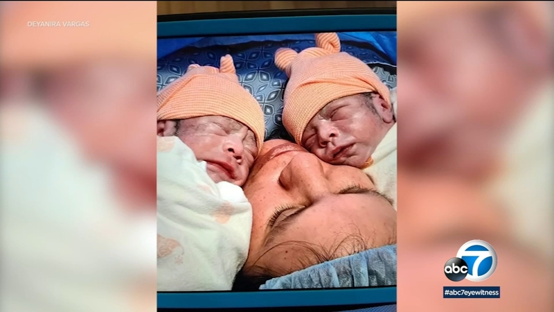 California mother delivers 'MoMo' twins in rare birth - ABC7 San Francisco