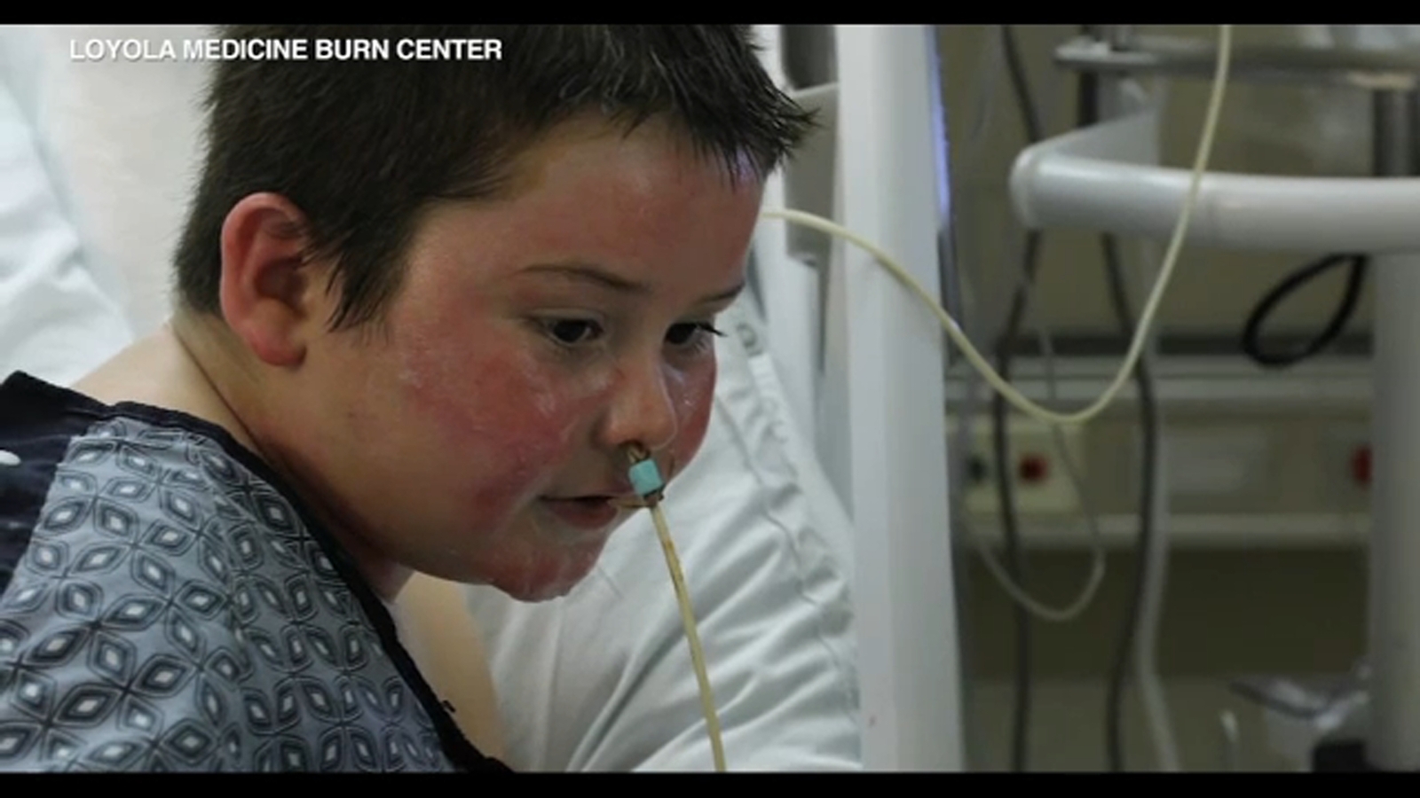 Chicago boy, 7, released from hospital after surviving fire that killed ...