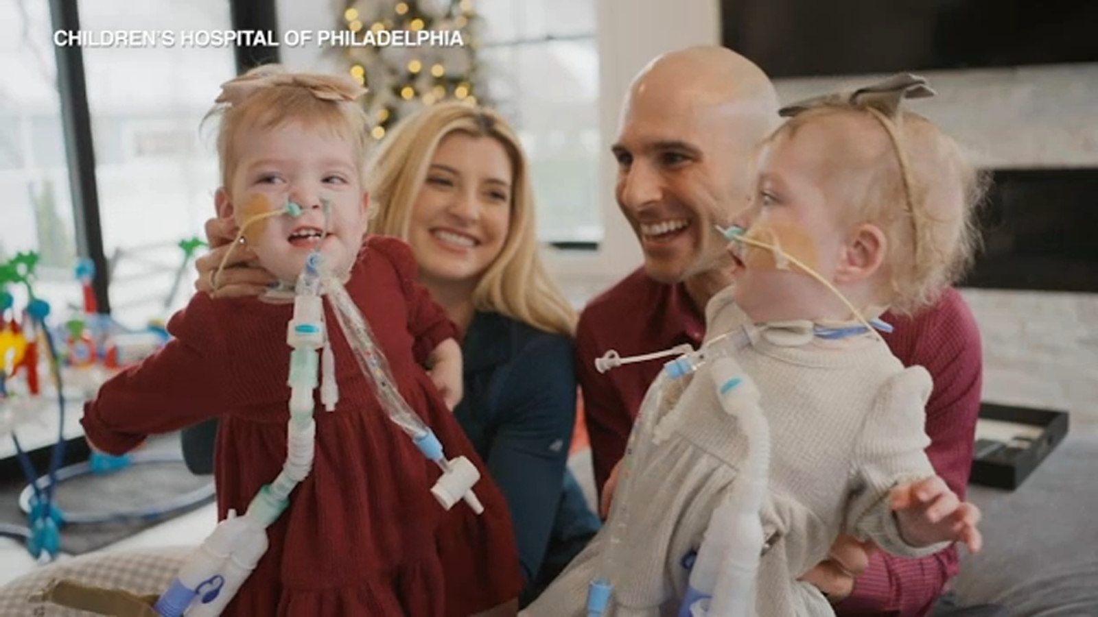 Altobelli conjoined twins: Family returns to Chicago after sisters ...
