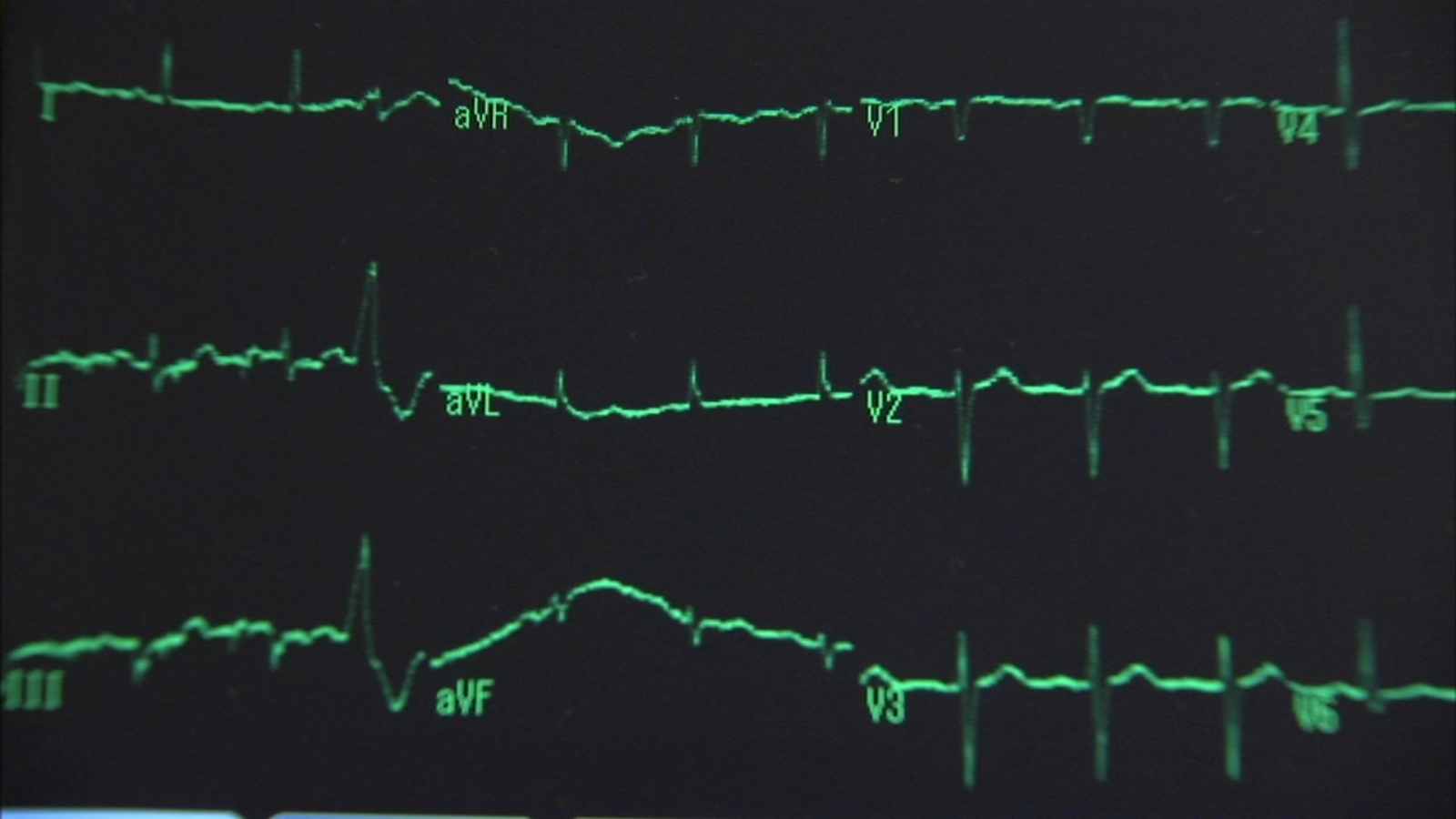 American Heart Association hosting Chicago Go Red for Women Luncheon at ...