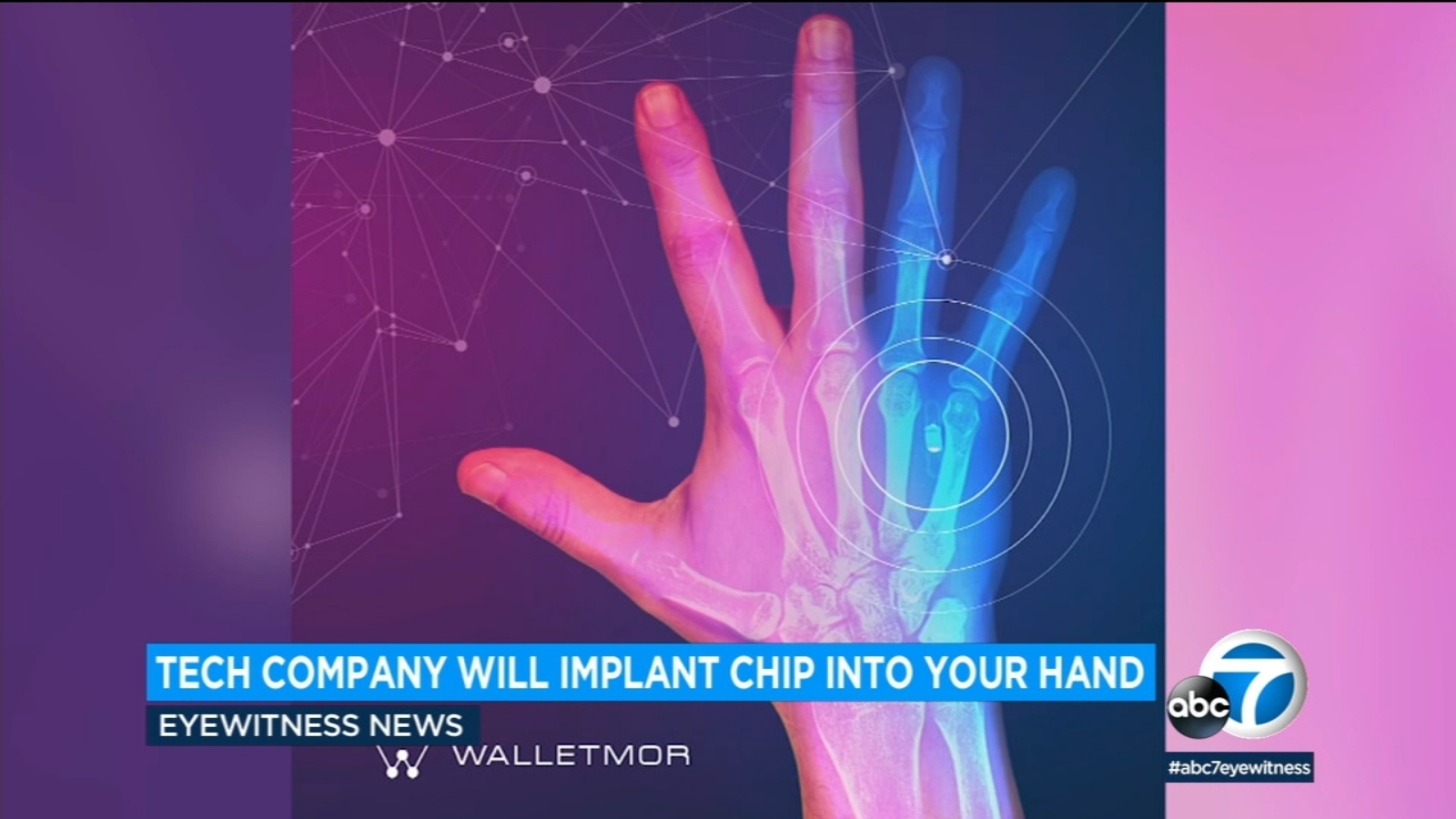 European tech company wants to implant microchips into your hand for ...