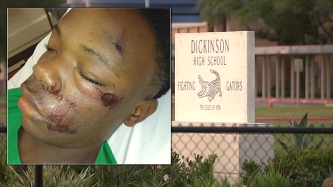 Humble ISD bullying attack: Boy with autism breaks arm while classmates ...
