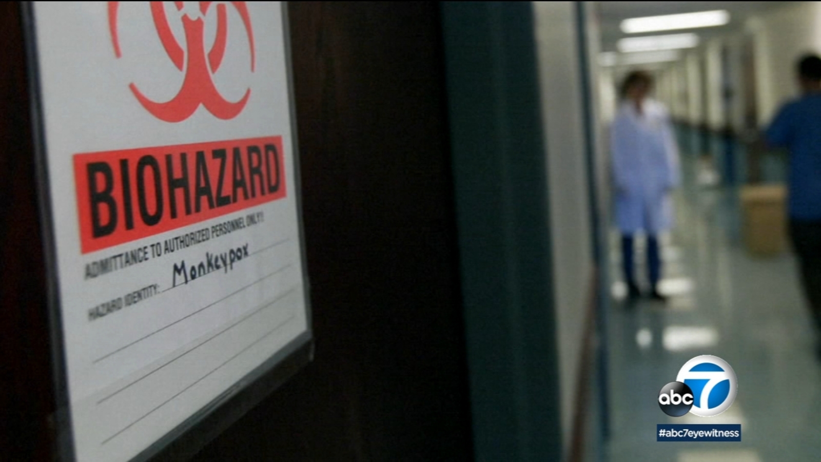 CDC educates doctors on monkeypox as California investigates its 1st ...