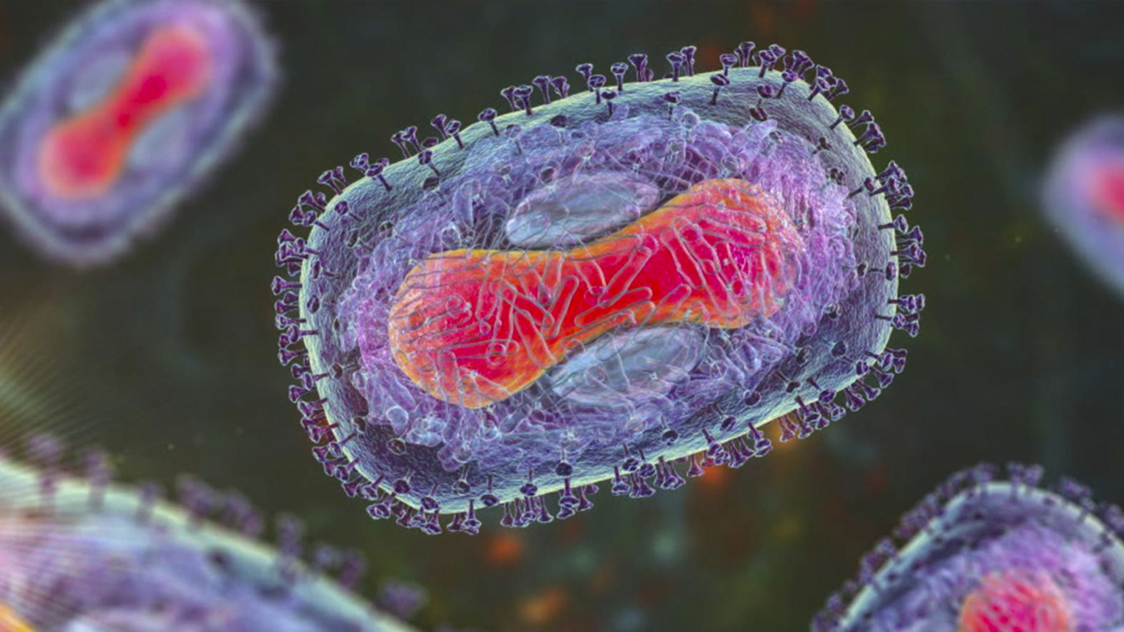 monkeypox-case-reported-in-cook-county-jail-flipboard