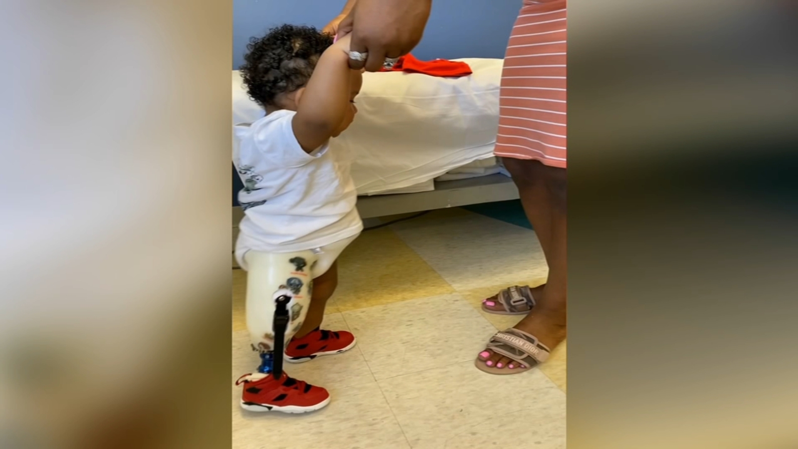 Dakari Miranda takes first steps with prosthetic leg made by doctors at ...