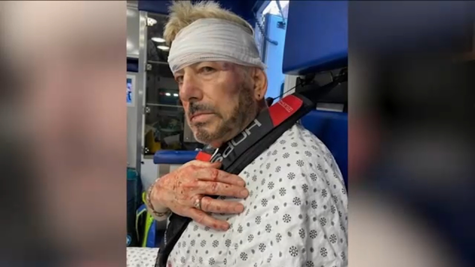 NYC crime: Victim of brutal subway attack says MTA, NYPD's enforcement ...