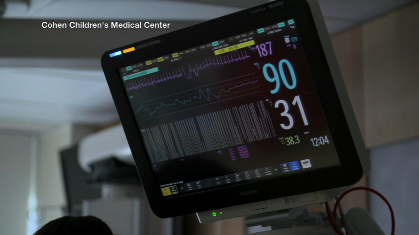 Demand for pediatric beds increases as RSV cases rise in children ...