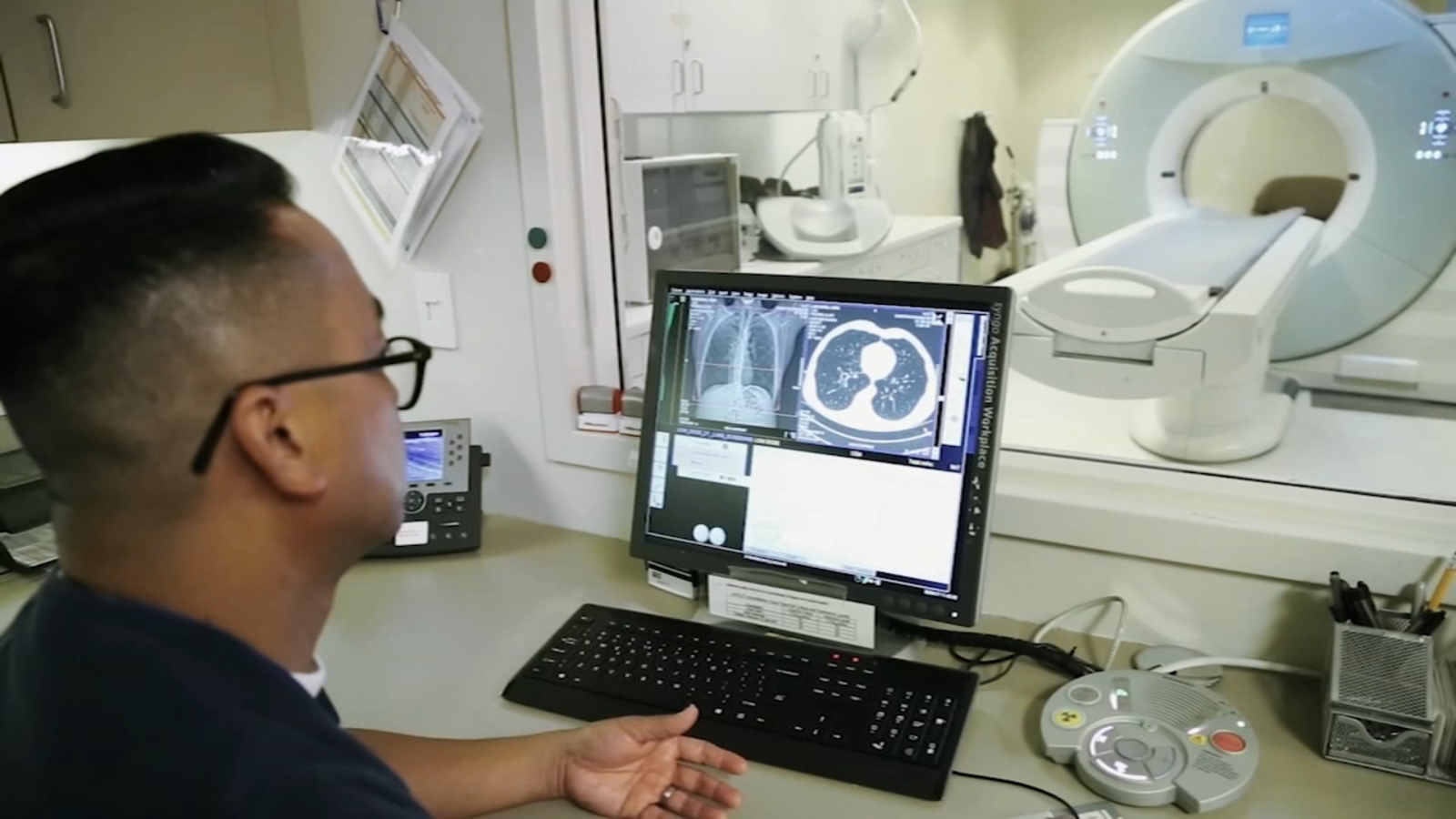 Triangle doctors using new low-dose CT scan to detect early stage lung ...