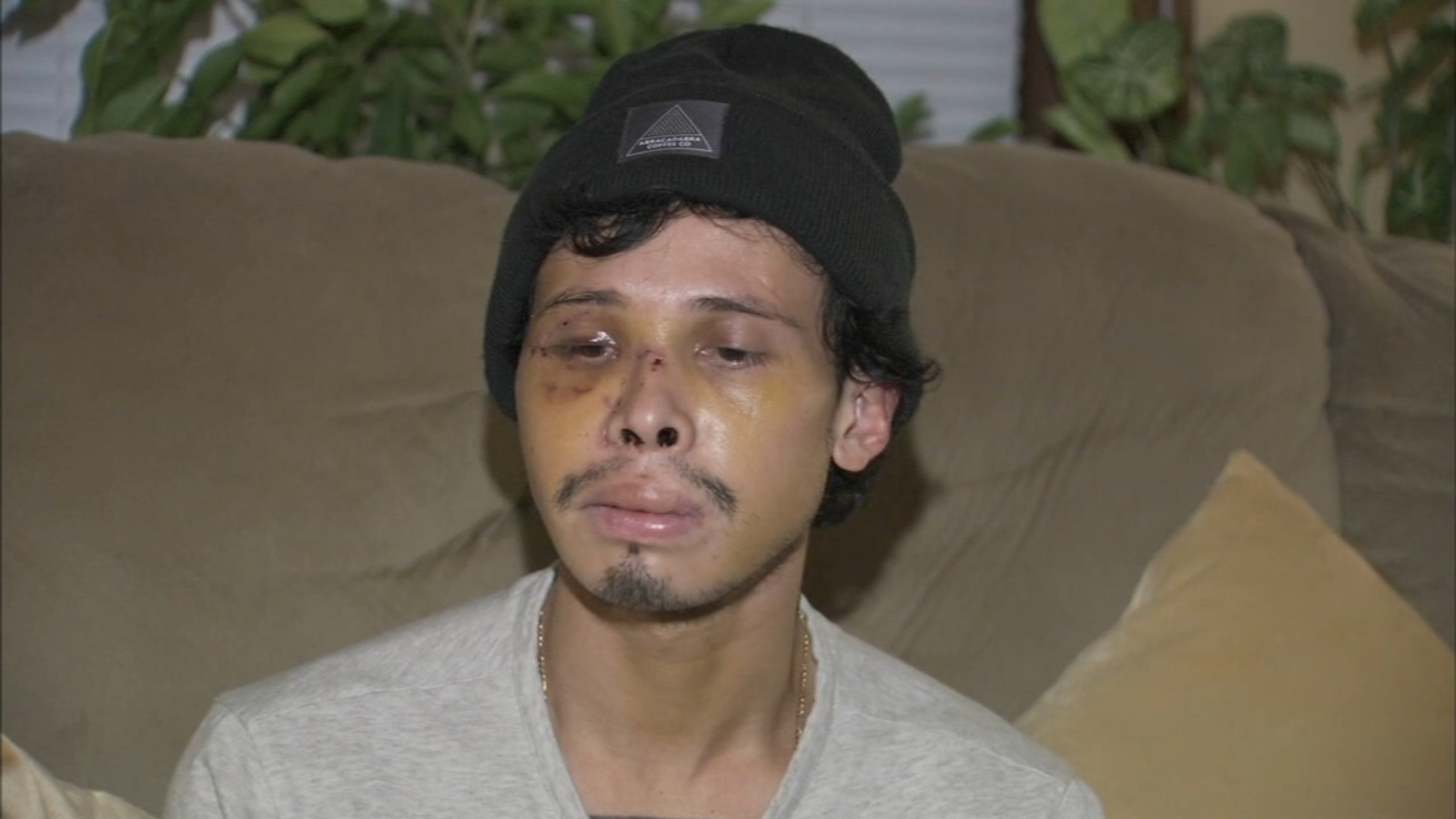 Schwa Chef Jose Duran badly injured after being pushed onto CTA Blue ...