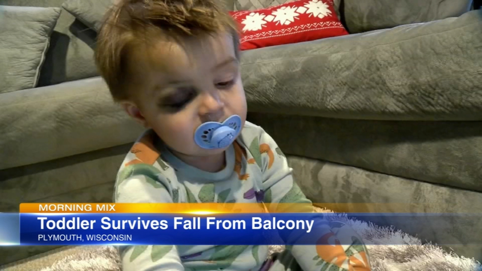 Wisconsin news: Child suffers head concussion, bruised eye after ...