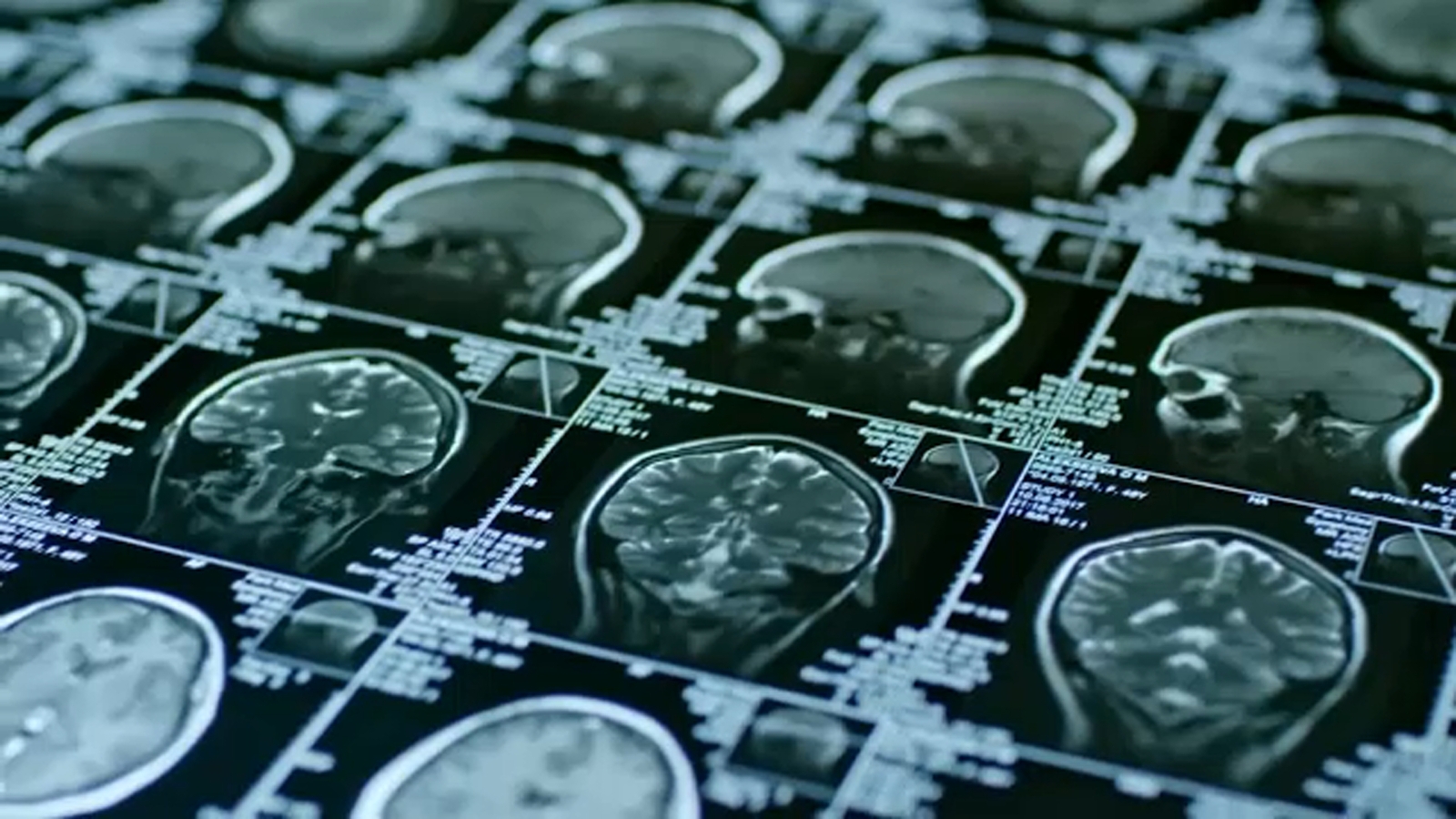 Scientists across country, Long Island make headway in fight against ...