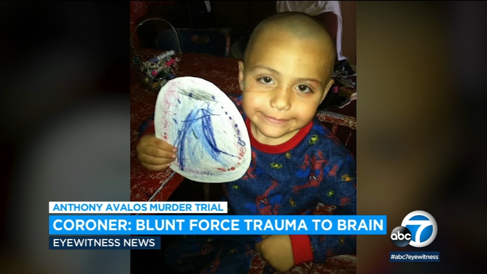 Anthony Avalos death: Coroner testifies that 10-year-old's brain showed ...