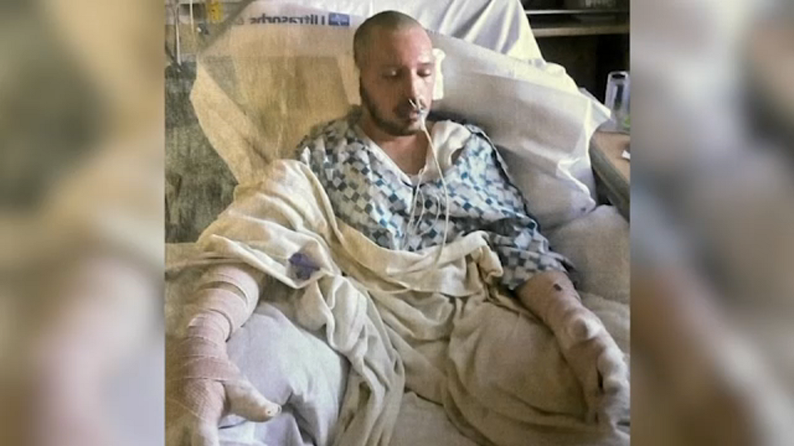 ONLY ON ACTION NEWS: Man recovering after fiery crash - ABC30 Fresno