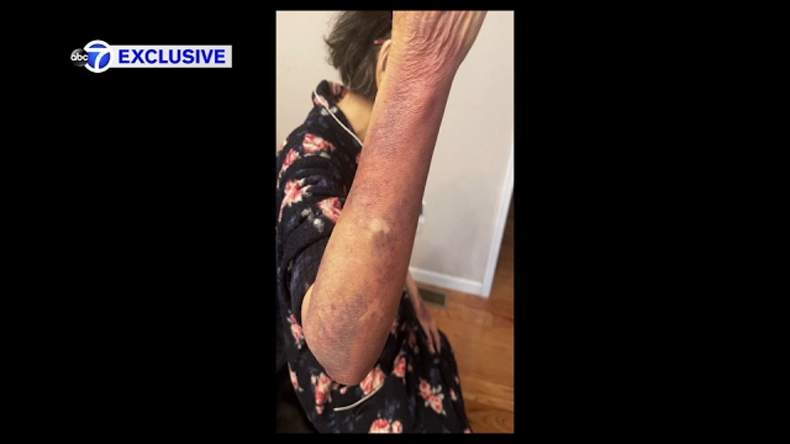 NYC crime: Elderly woman left black-and-blue in Queens jewelry store ...