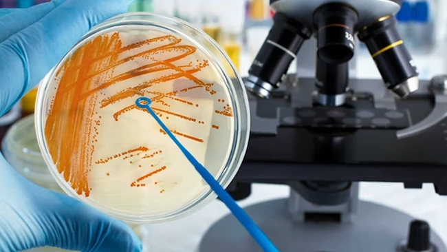 Invasive group A strep on the rise in parts of the US: What to know ...