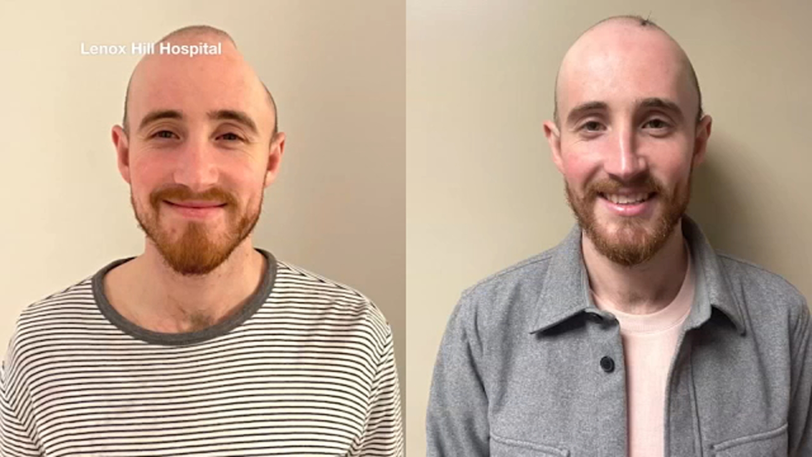 Lenox Hill Hospital doctor's innovative reconstructive procedure brings ...