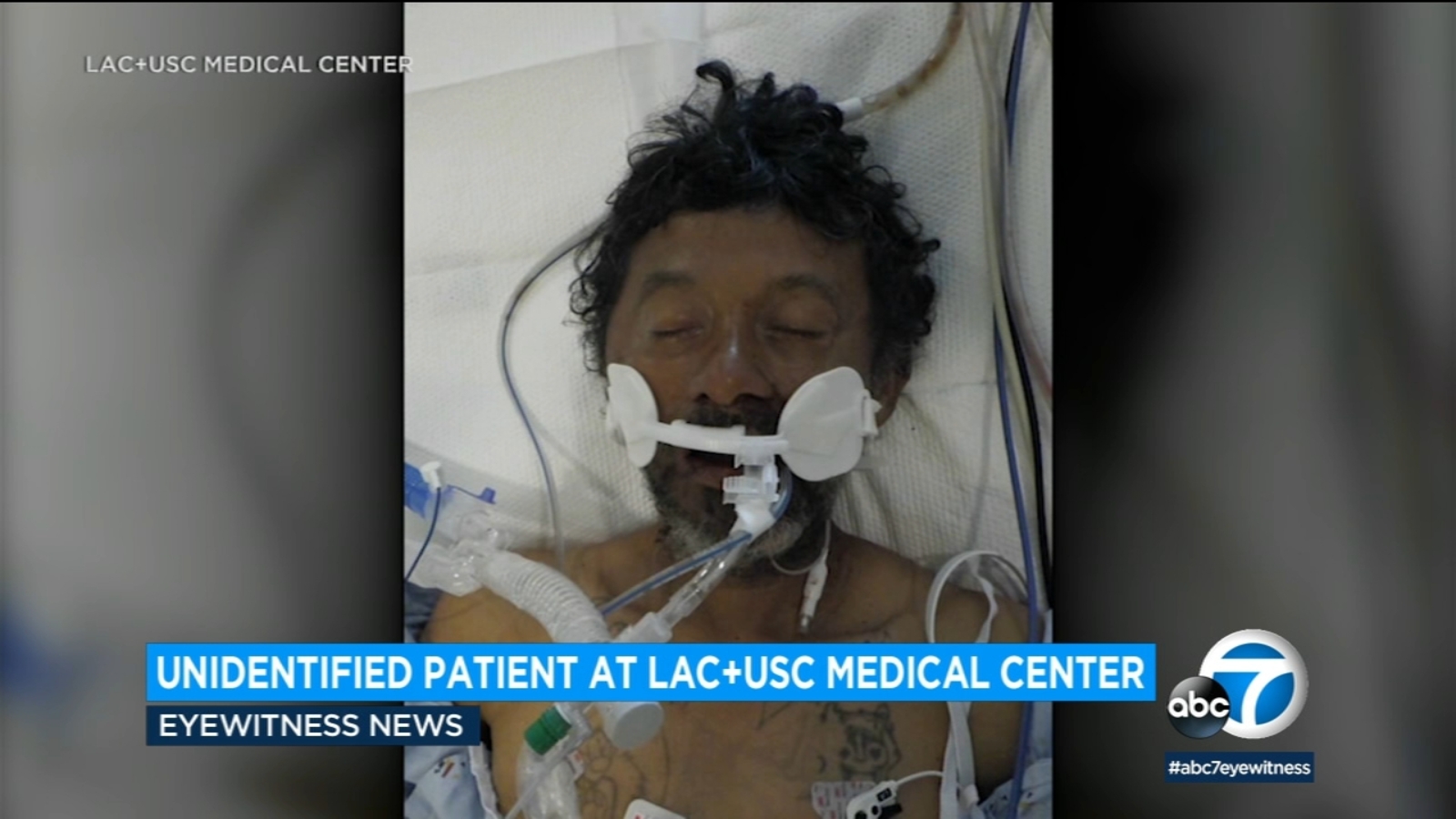 LAC + USC Medical Center seeking public's help in identifying male ...