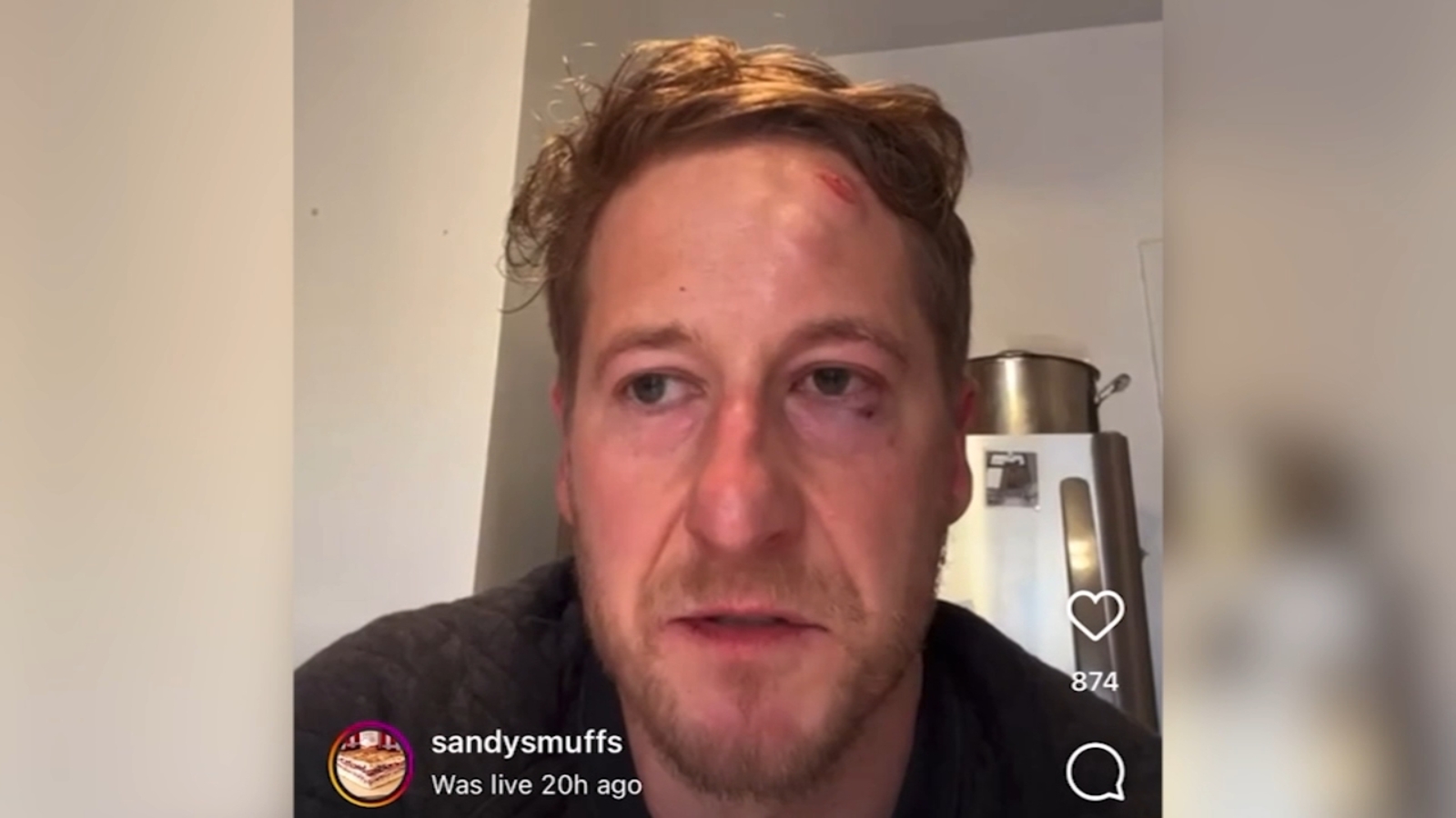 Owner of Sandy's Peterson Harter punched in face by man urinating ...