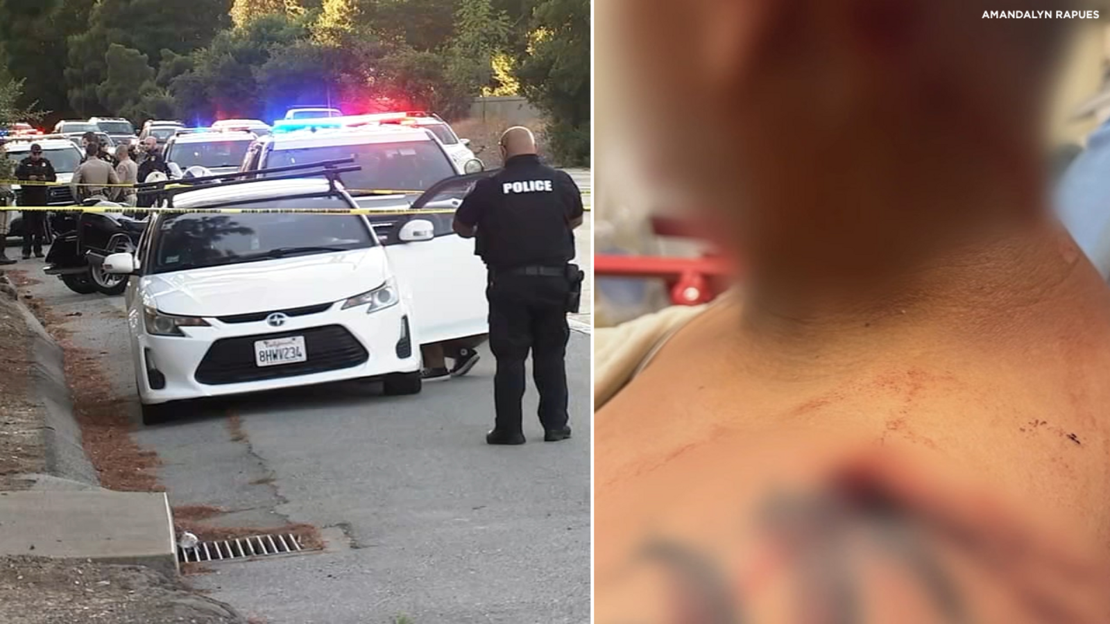 Bay Area road rage victim grateful to be alive after unprovoked I-280 ...