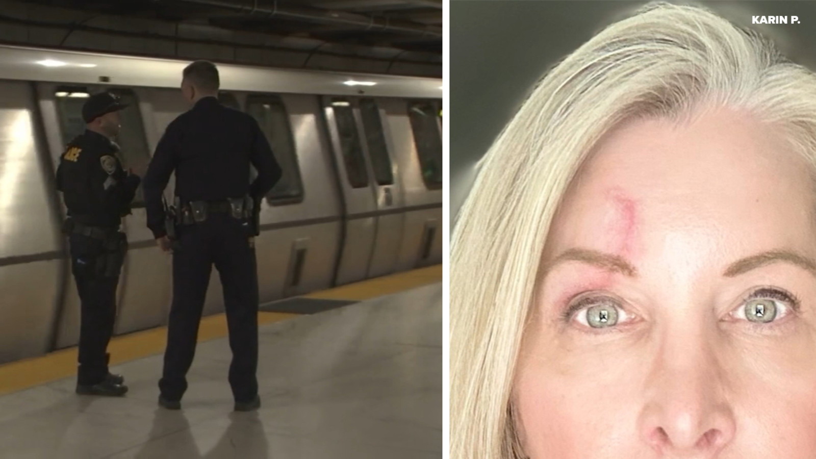 Woman followed, attacked on BART by unknown assailant says she won't ...
