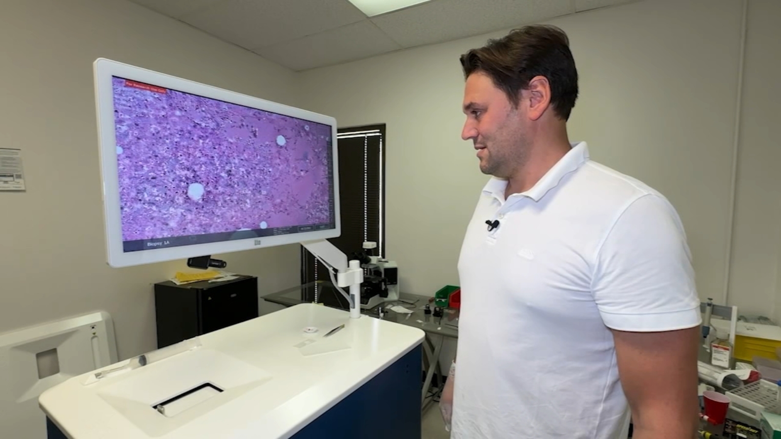 Santa Clara startup Invenio Imaging uses AI to speed up cancer cell ...