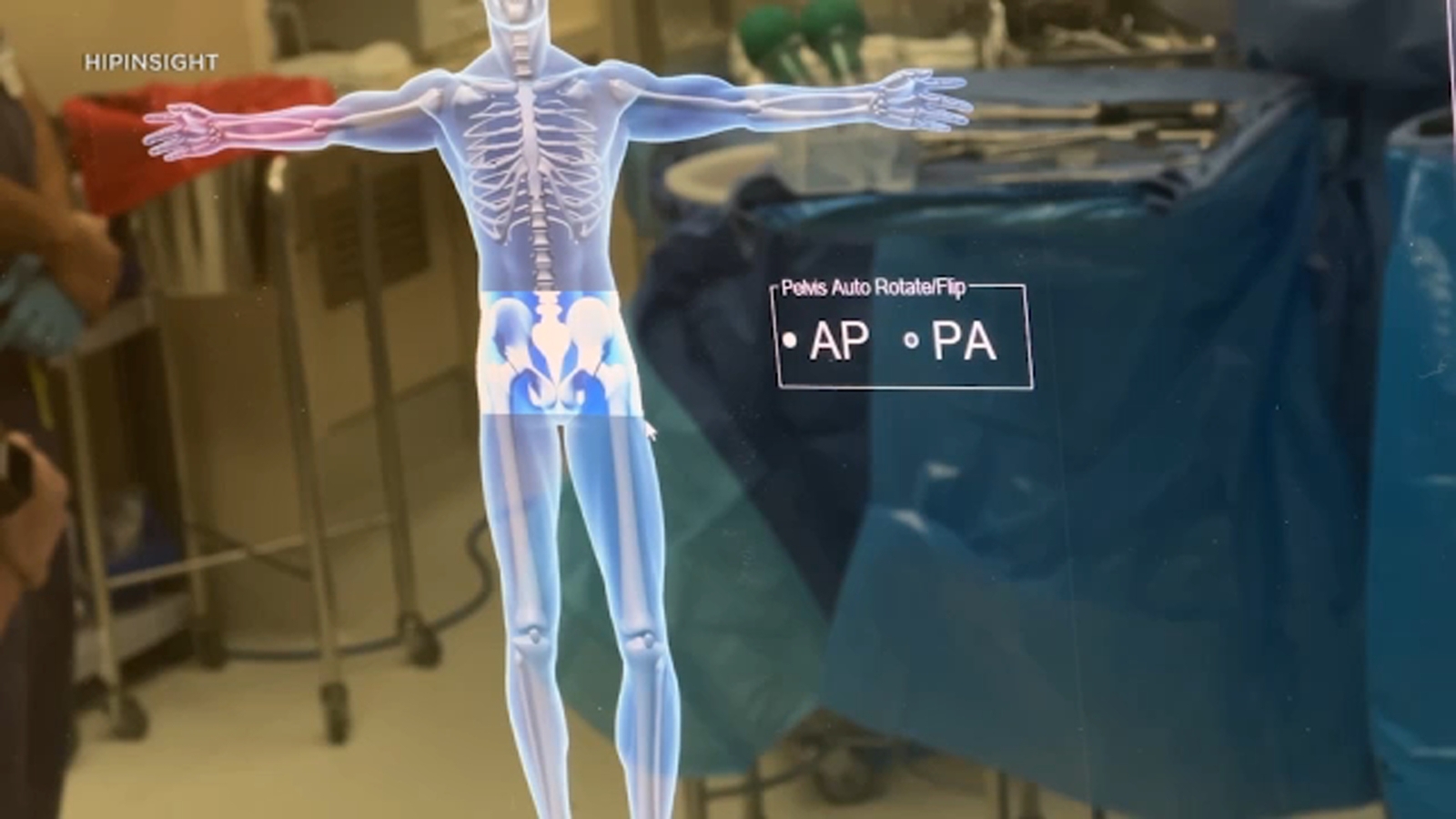 Torrance hospital revolutionizes hip surgery with augmented reality in ...