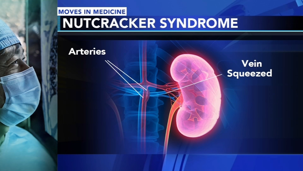 Nutcracker Syndrome Causes Nutcracker Syndrome: How To Diagnose It And