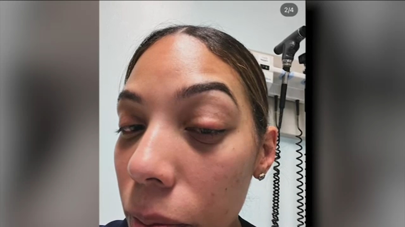 Repeat offender on loose after assaulting ER nurse while vitals were ...