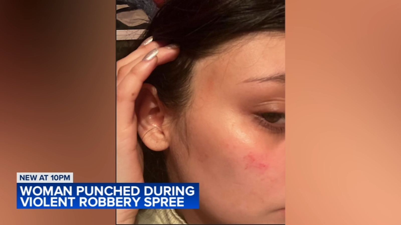 Mayfair, Chicago robberies: Young woman punched, robbed while walking ...