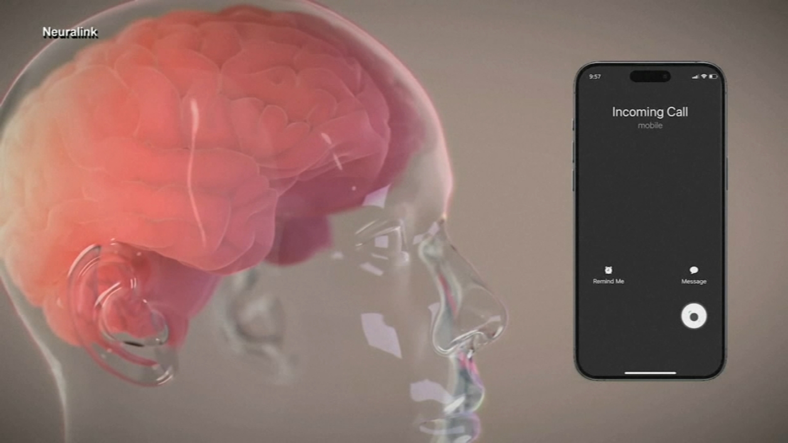 Elon Musk's Neuralink is seeking a second person to test its brain chip ...