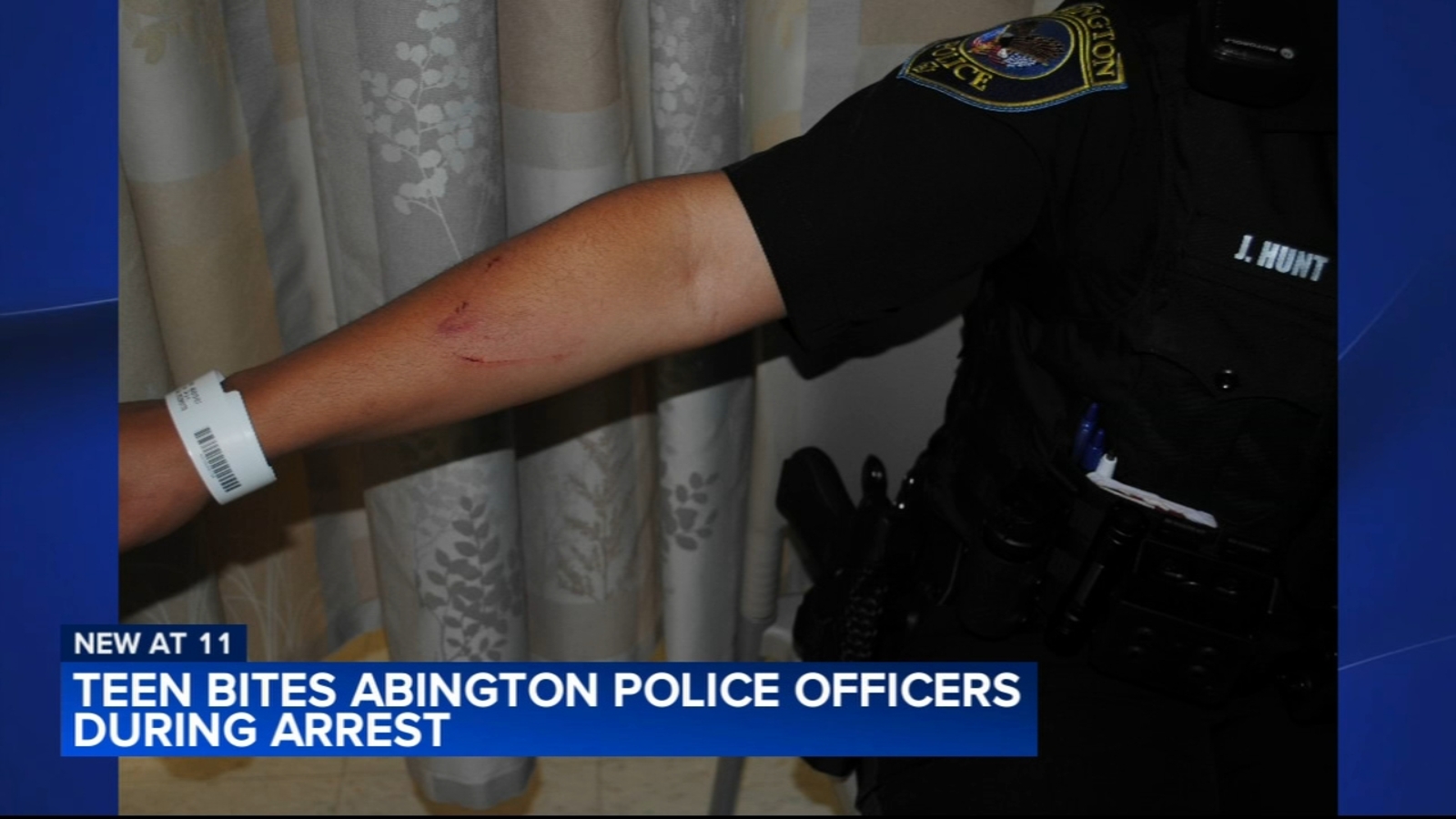 2 Abington Township police officers bitten during arrest of shoplifting ...