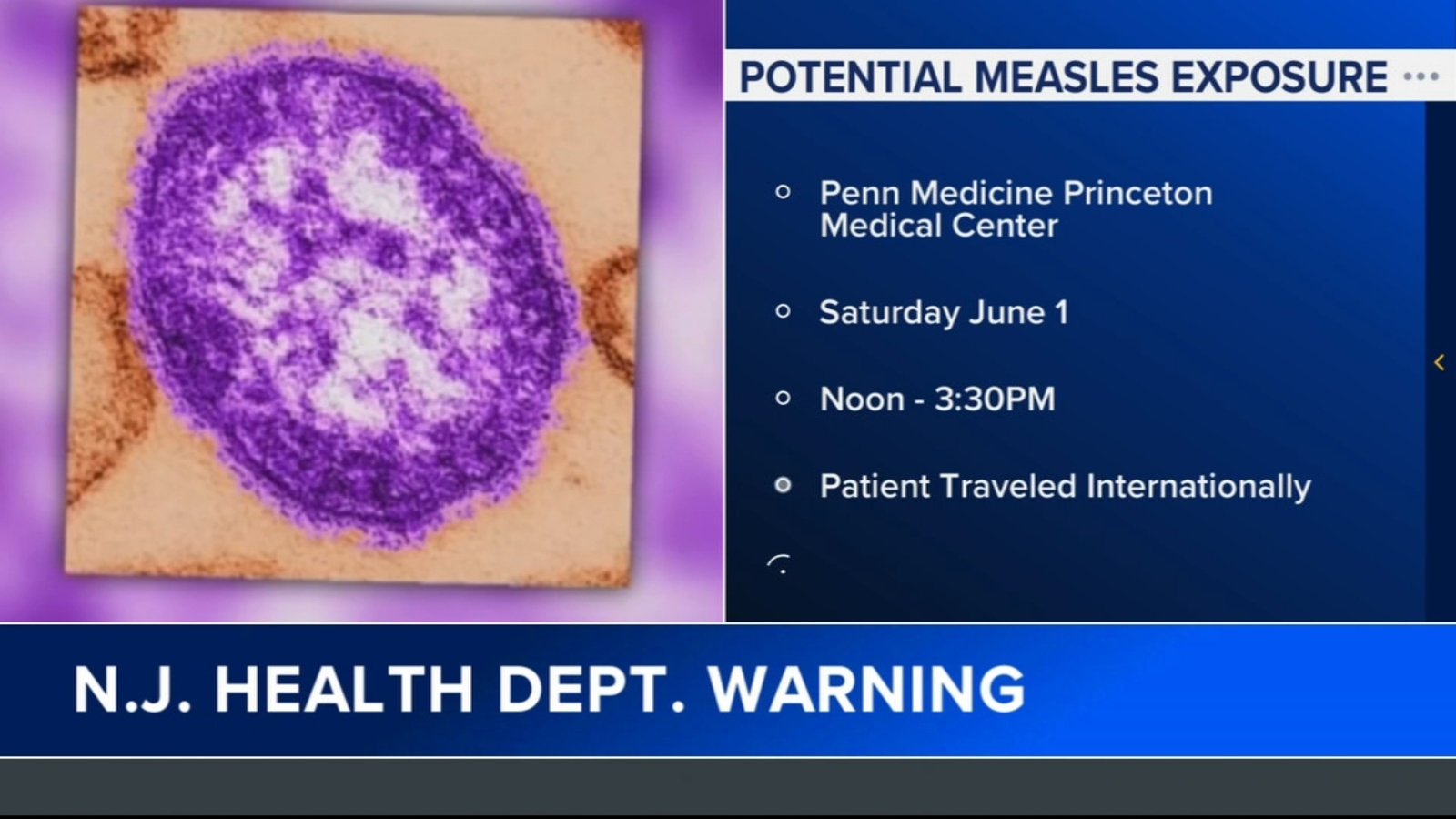 Residents warned of potential measles exposure at Penn Medicine ...