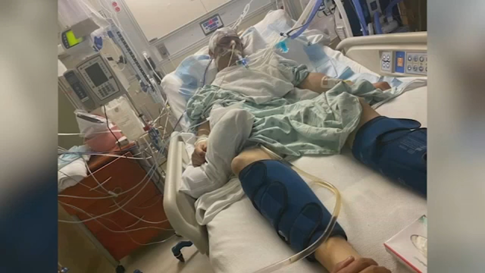 Jose Sixtos, 16, remains in a coma after colliding with HPD cruiser ...