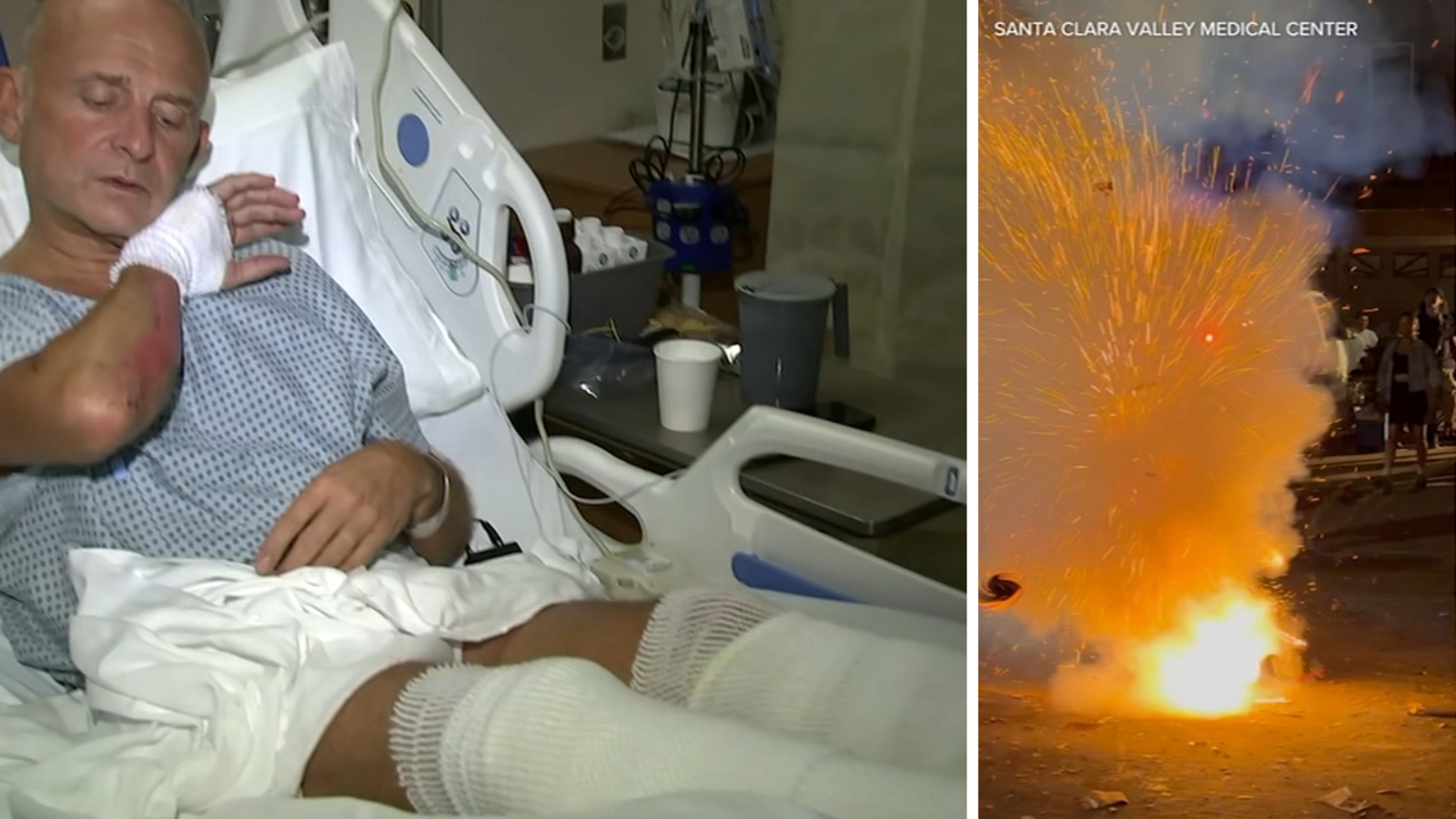 Man injured with burns after being hit by illegal fireworks near Alviso ...