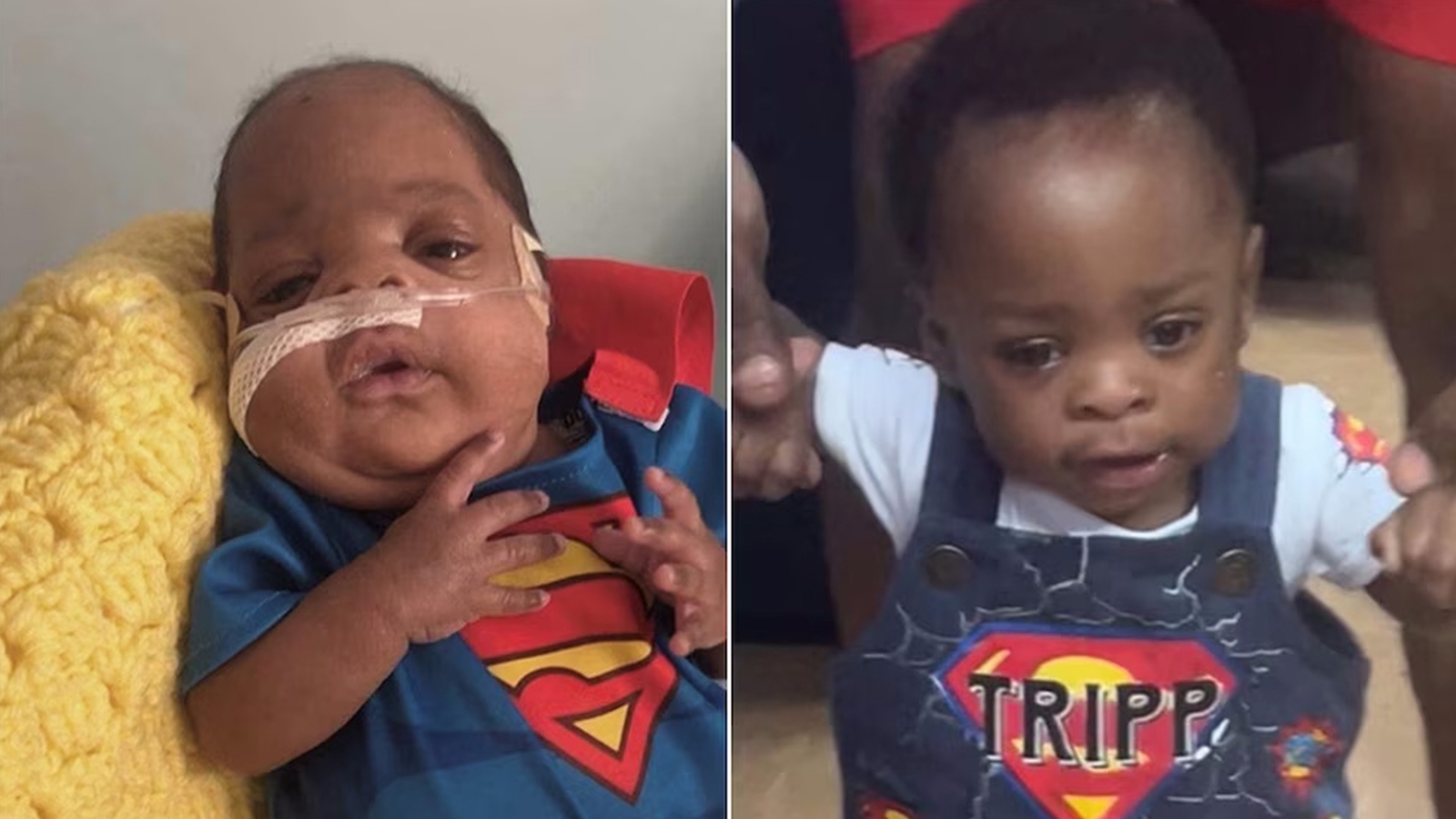 Herron Abney III: Baby born weighing less than 1 pound celebrates 1st ...