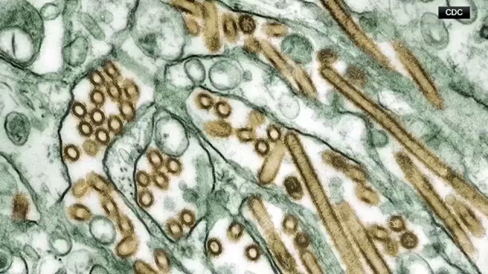 Bird flu in Texas: 1st positive case of Avian Influenza (H5N1 ...