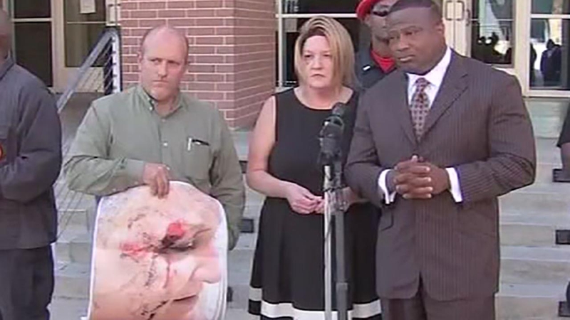 Woman Claims Harris County Deputy Assaulted Her Outside Local Bar