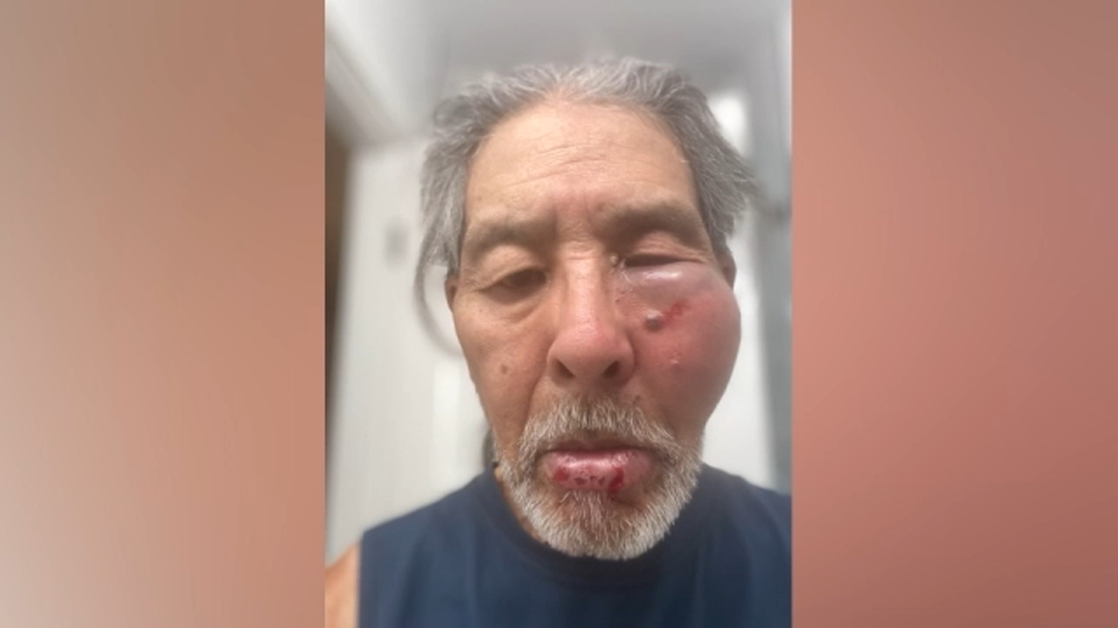 East Los Angeles College professor attacked in possible hate crime ...