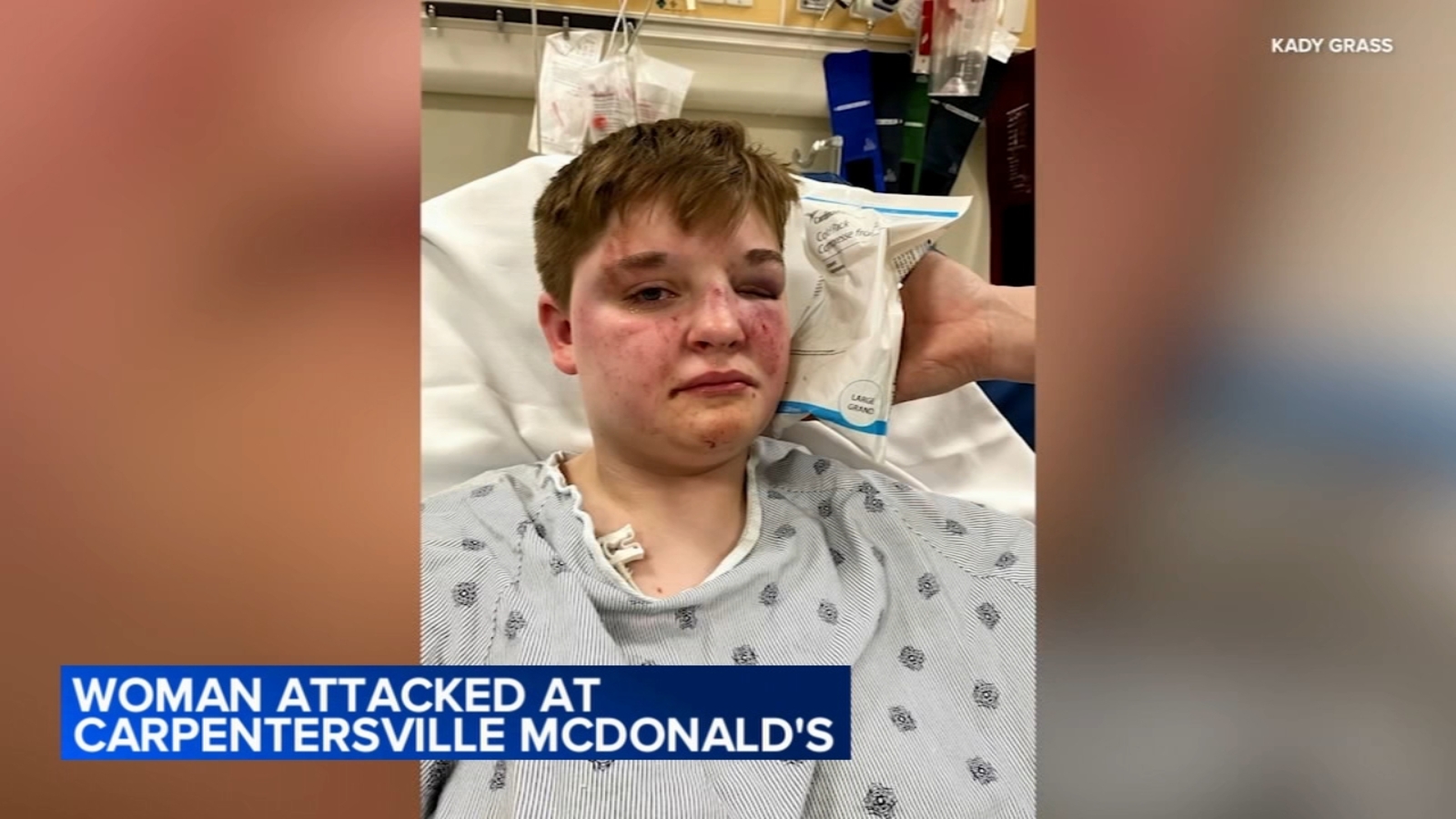 Kady Grass seriously injured, knocked unconscious in allegedly ...