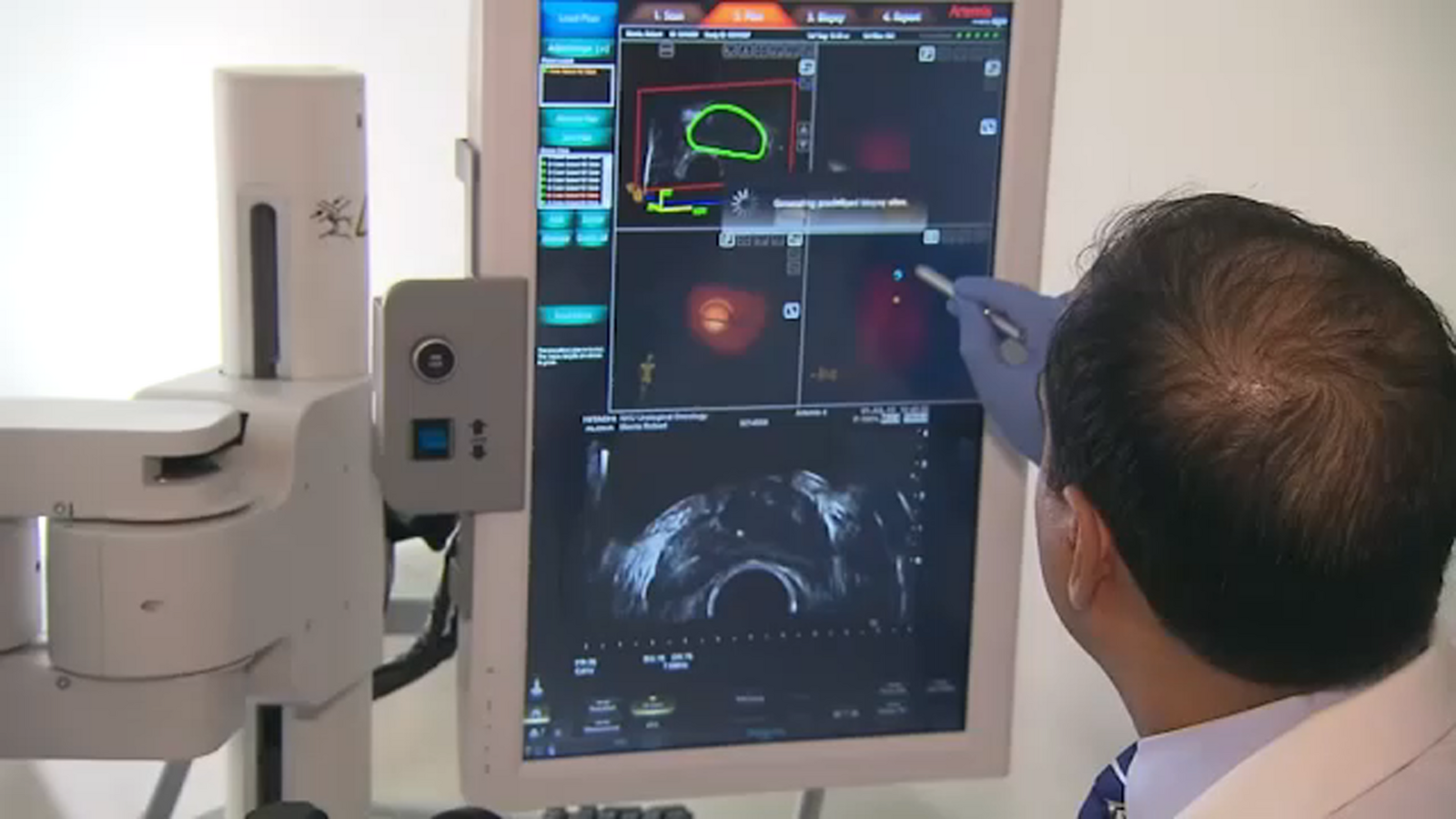 Valley doctors urging men to get prostate cancer screenings - ABC30 Fresno