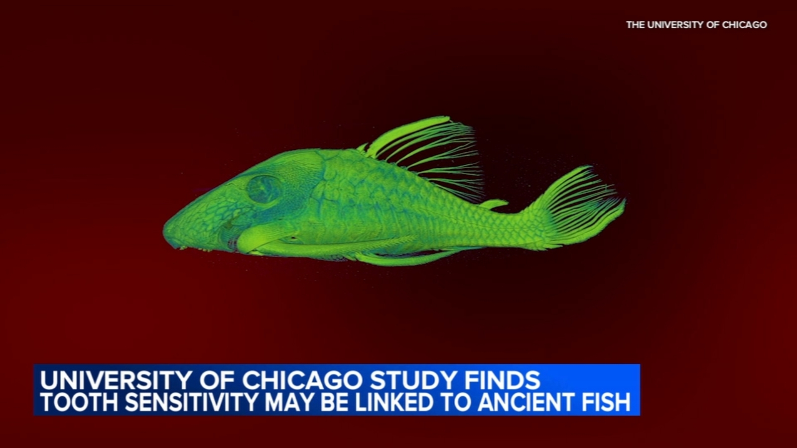 University of Chicago study finds tooth sensitivity may be linked to ...